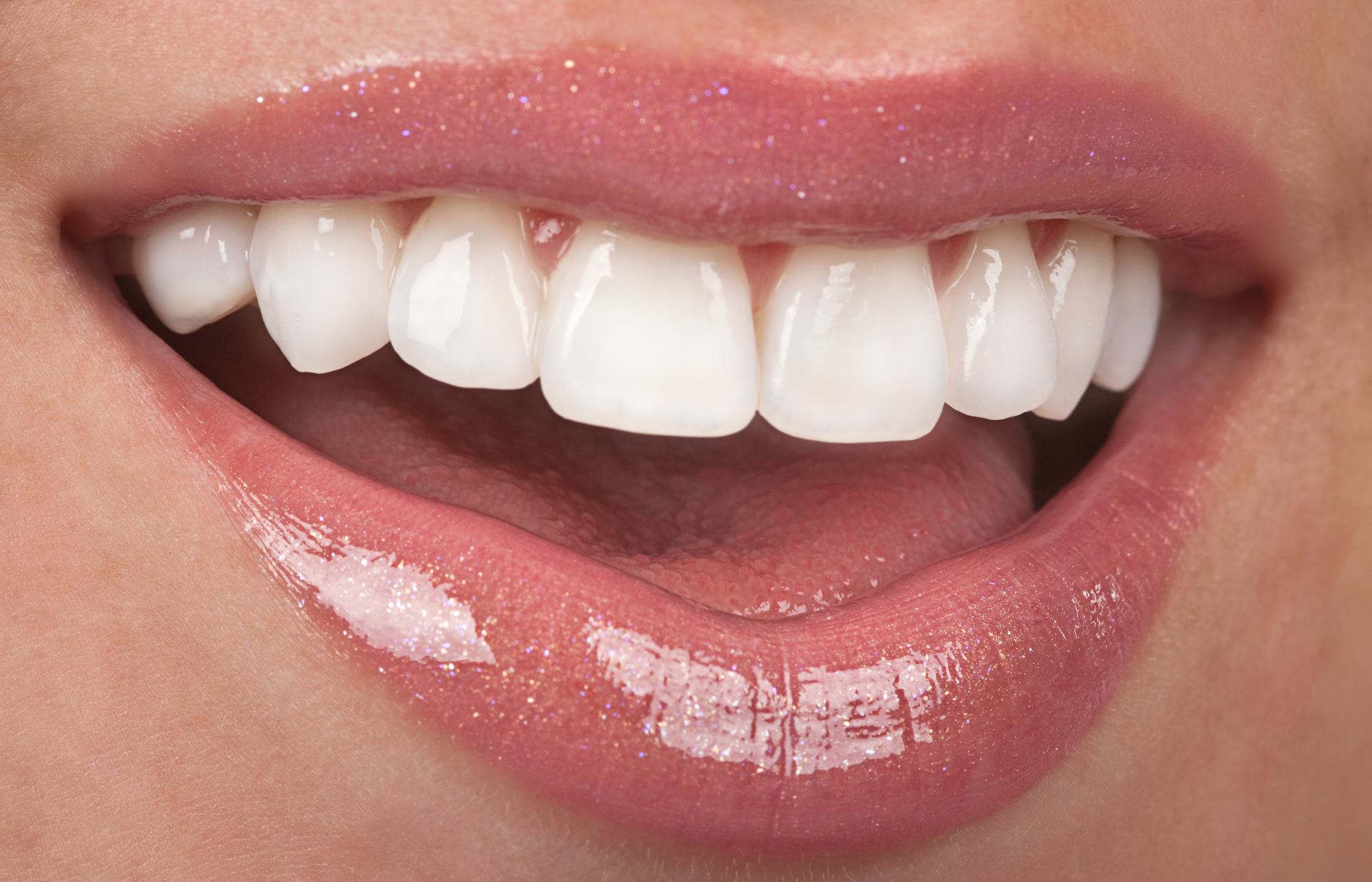 Beautiful Teeth Austin Laser Dentist Helen Ragsdale Dds Austin
