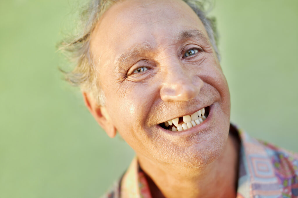 Life After Adult Tooth Loss - Helen Ragsdale DDS - Austin, TX
